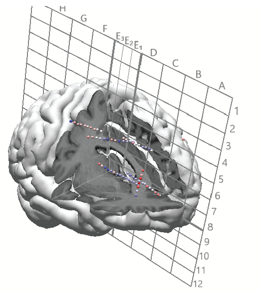 Powered By Curry™ Neuroimaging Platform Compumedics Neuroscan Orion Lifespan Meg